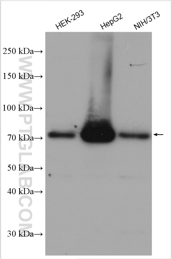 ACSL4/FACL4 antibody (22401-1-AP) | Proteintech | 武汉三鹰生物技术有限公司