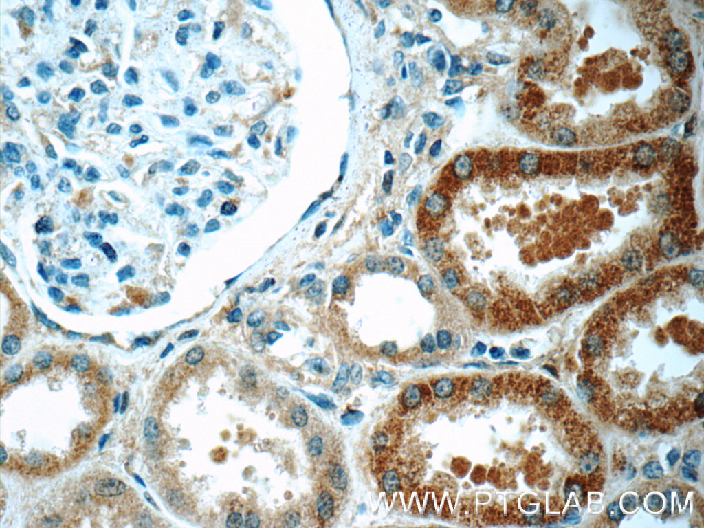 ACSM3 antibody (10168-2-AP) | Proteintech | 武汉三鹰生物技术有限公司