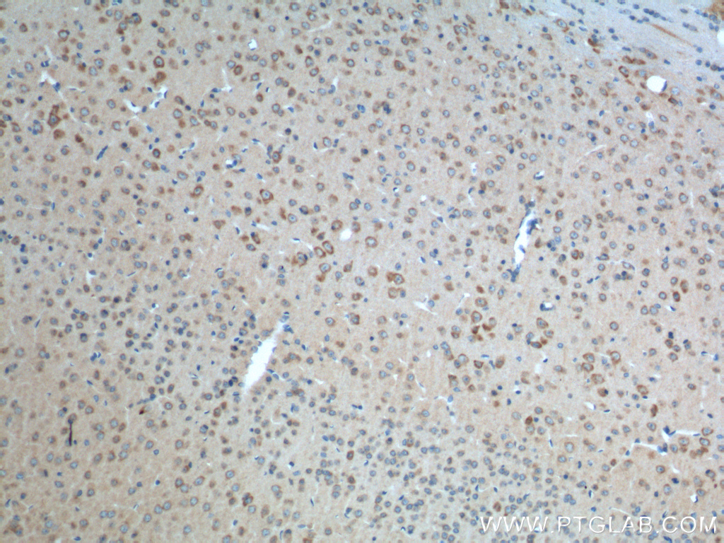 ADRA2A antibody (14266-1-AP) | Proteintech | 武汉三鹰生物技术有限公司