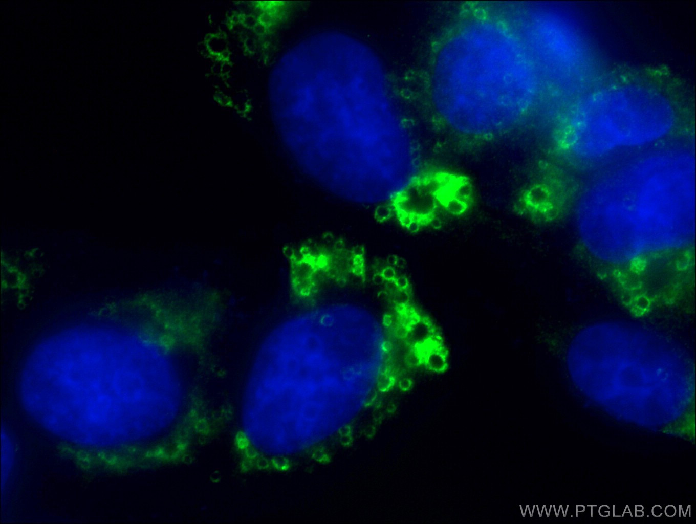 ADRP/Perilipin 2 Antibody 15294-1-AP | Proteintech