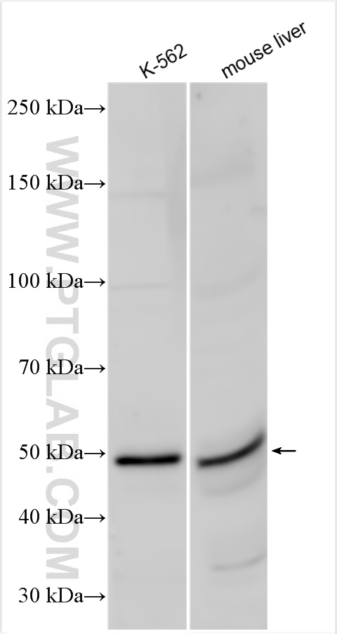 ADRP/Perilipin 2 antibody (15294-1-AP) | Proteintech | 武汉三鹰生物技术有限公司