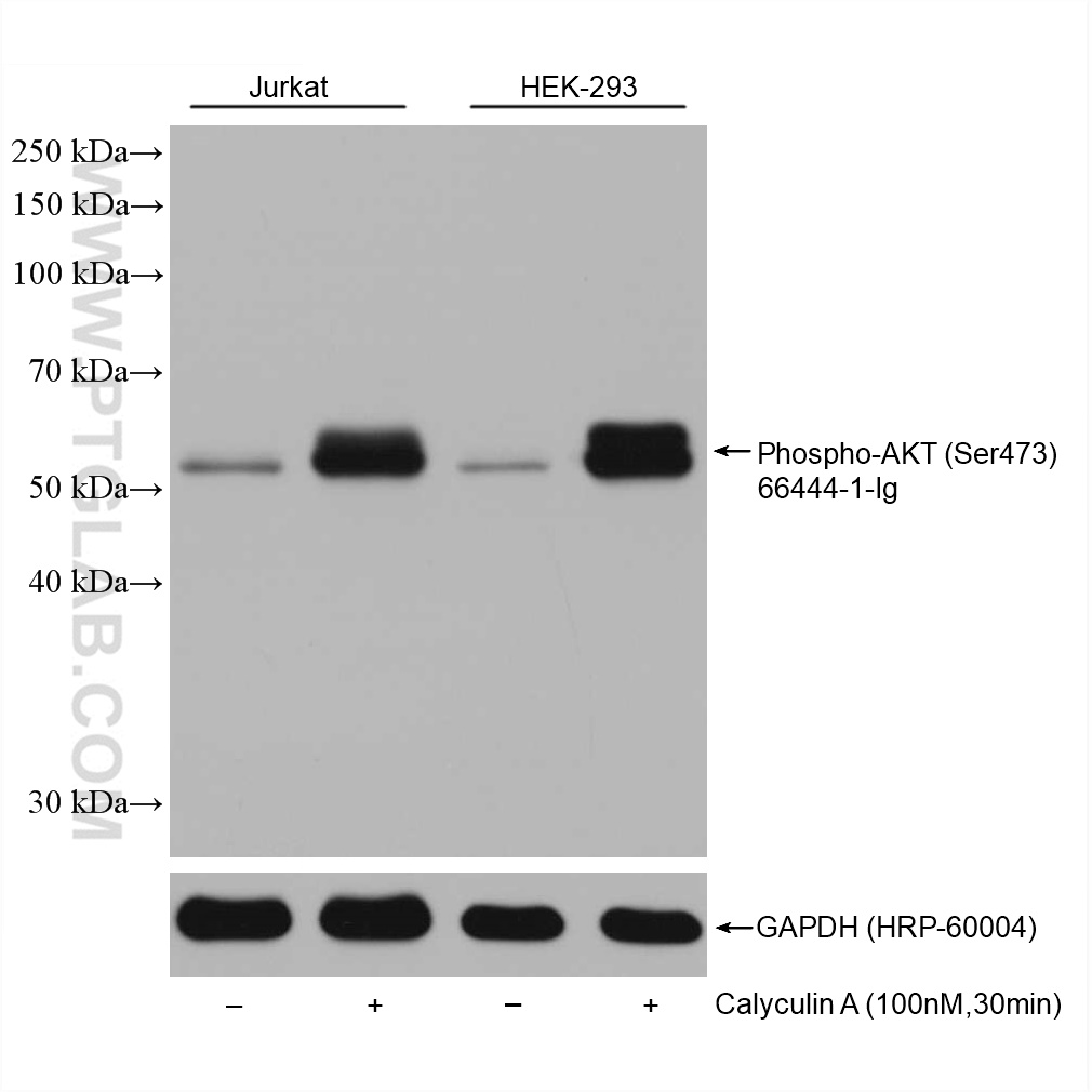 Phospho-AKT (Ser473) antibody (66444-1-Ig) | Proteintech | 武汉三鹰生物技术有限公司