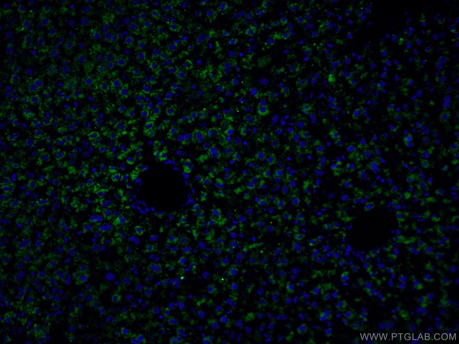 Albumin Antibody 16475-1-AP | Proteintech