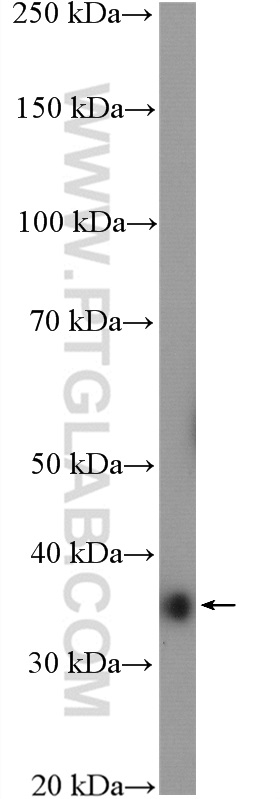 ANKRD1 antibody (11427-1-AP) | Proteintech | 武汉三鹰生物技术有限公司