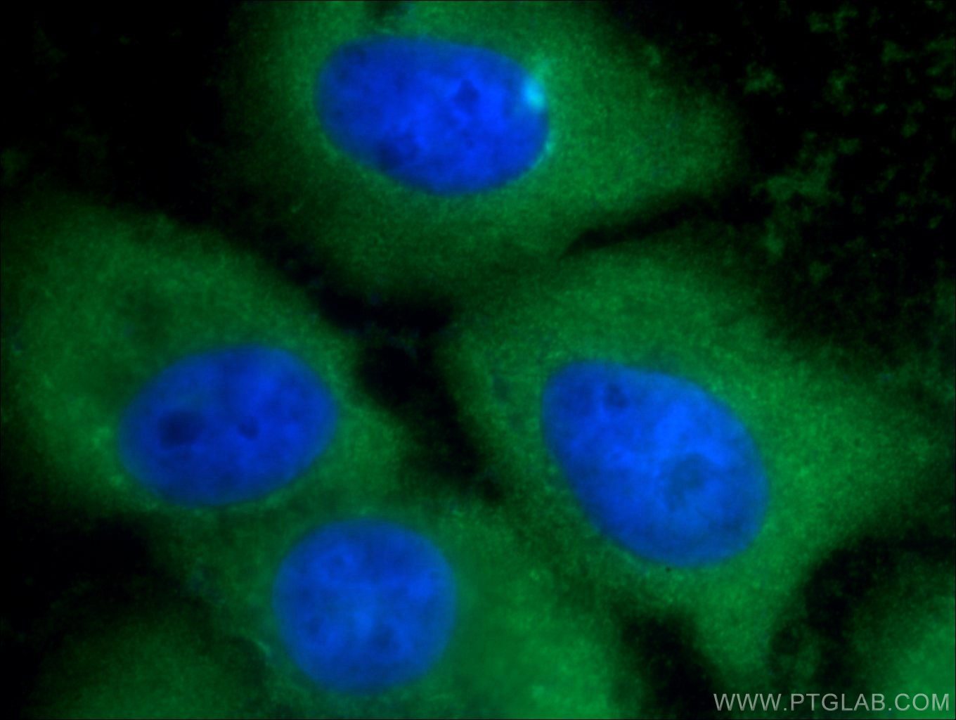 Annexin A1 antibody (21990-1-AP) | Proteintech | 武汉三鹰生物技术有限公司