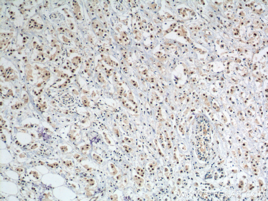 APOBEC3B antibody (14559-1-AP) | Proteintech | 武汉三鹰生物技术有限公司