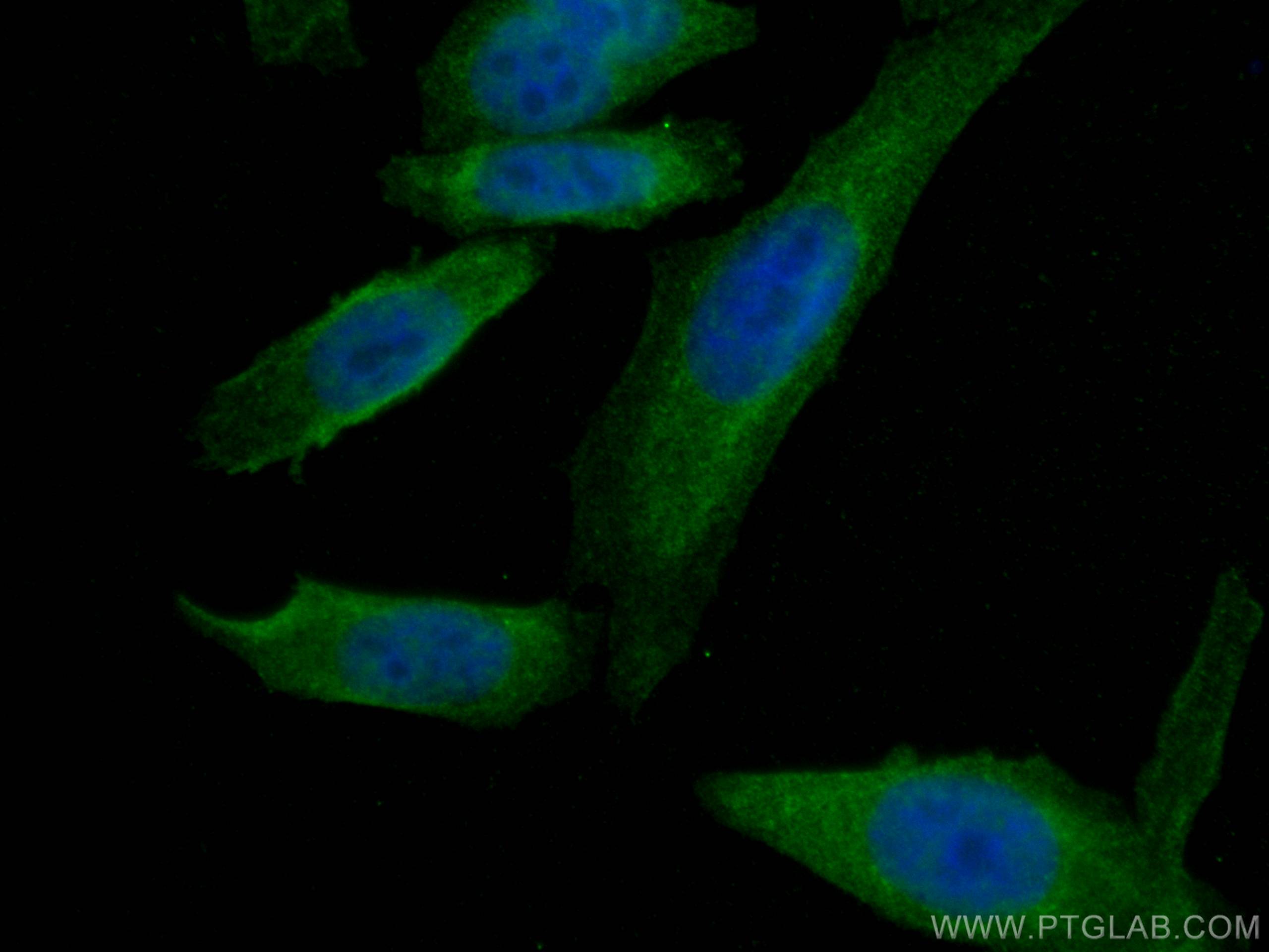 APOE antibody (66830-1-Ig) | Proteintech | 武汉三鹰生物技术有限公司