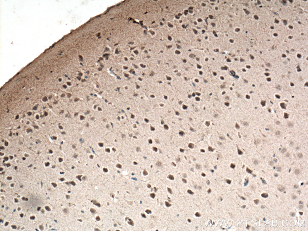 APOE Antibody 66830-1-Ig | Proteintech