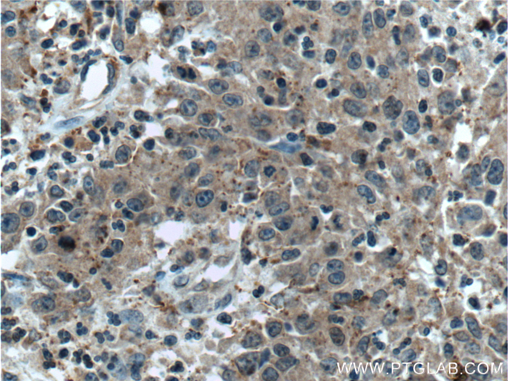 TNFSF13 antibody (10680-1-AP) | Proteintech