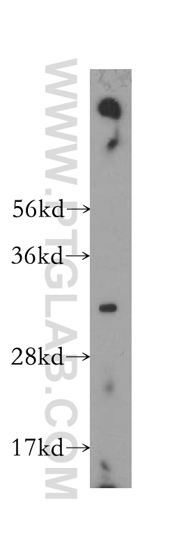 TNFSF13 antibody (10680-1-AP) | Proteintech