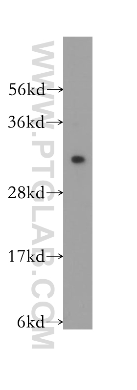 TNFSF13 antibody (10680-1-AP) | Proteintech