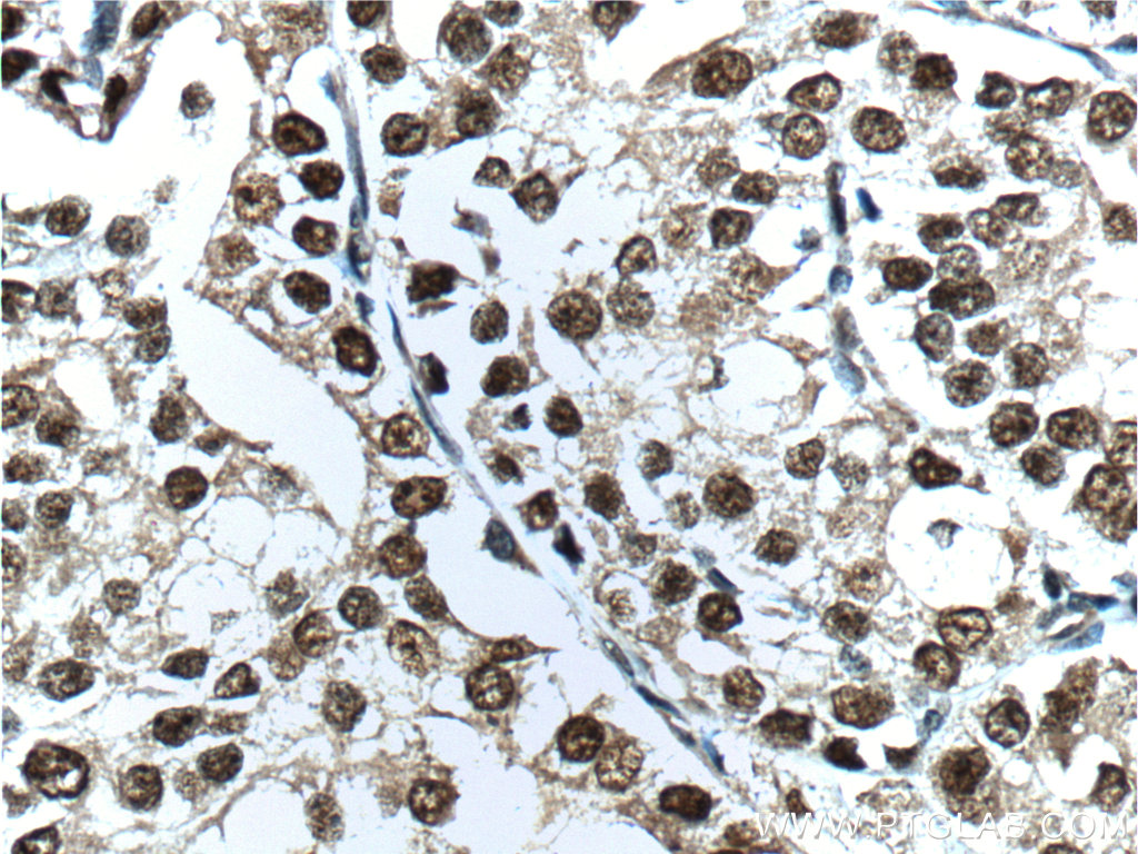 androgen receptor antibody (22089-1-AP) | Proteintech