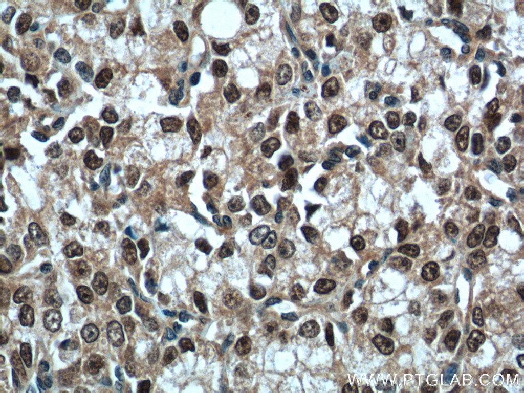 androgen receptor antibody (22089-1-AP) | Proteintech