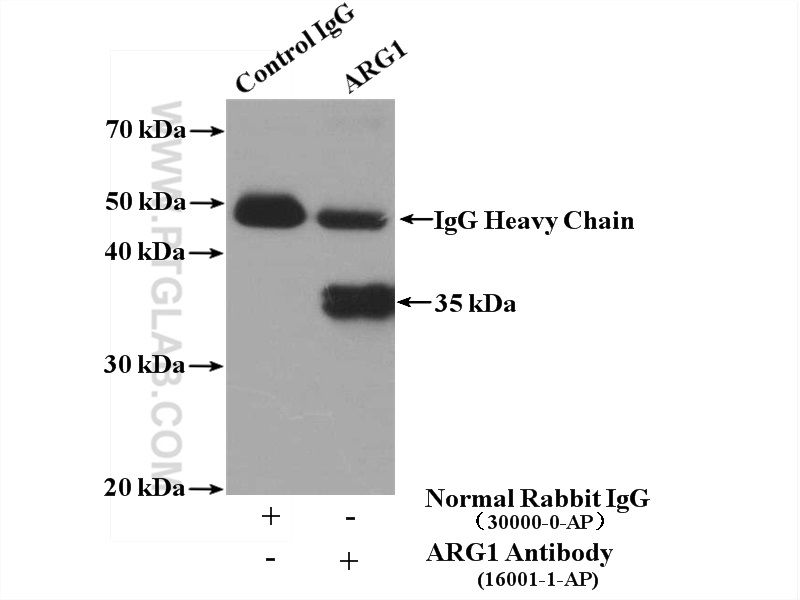 Arginase-1 antibody (16001-1-AP) | Proteintech | 武汉三鹰生物技术有限公司