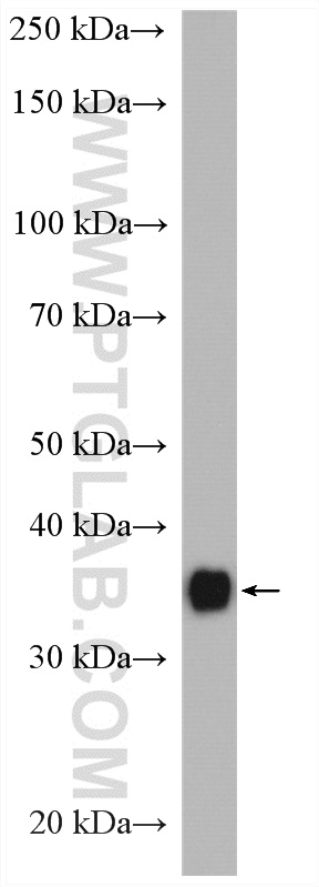 ARG1 Antibody 16001-1-AP | Proteintech