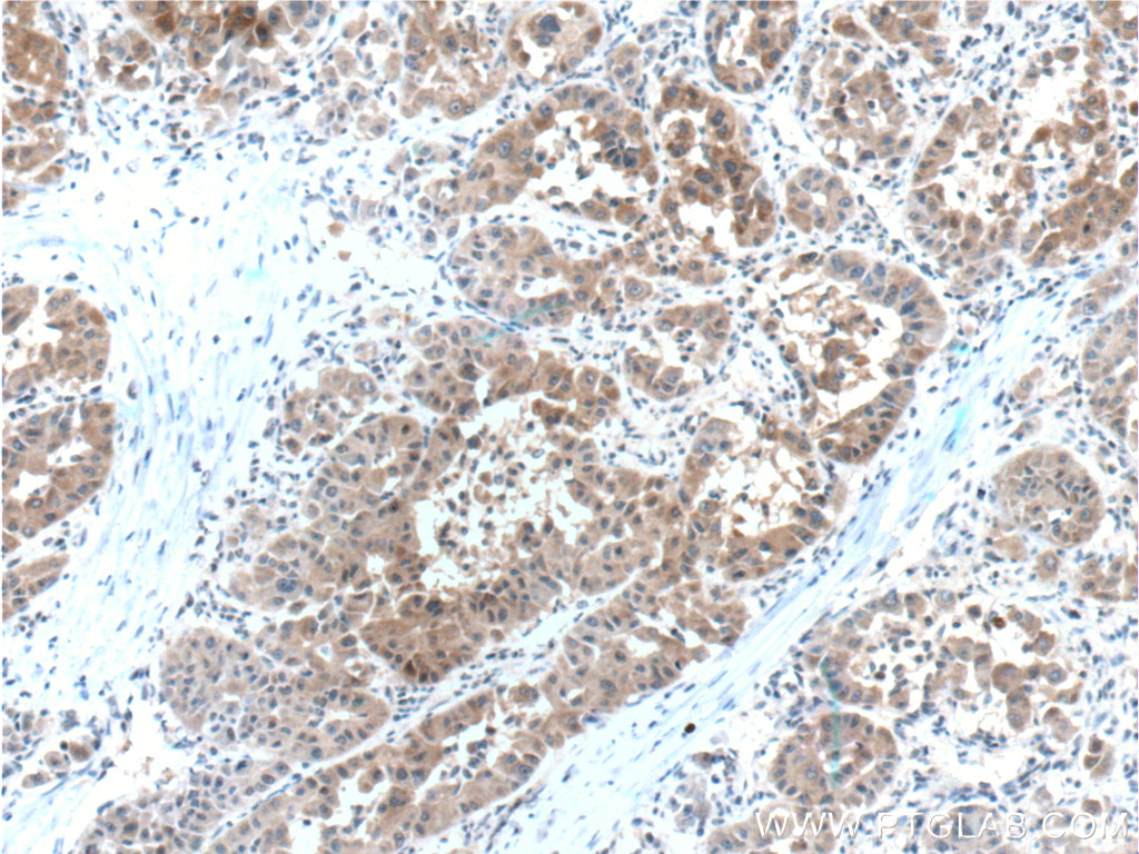 Arginase-1 antibody (66129-1-Ig) | Proteintech | 武汉三鹰生物技术有限公司
