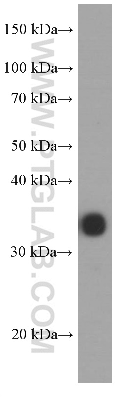 Arginase-1 Antibody 66129-1-Ig | Proteintech