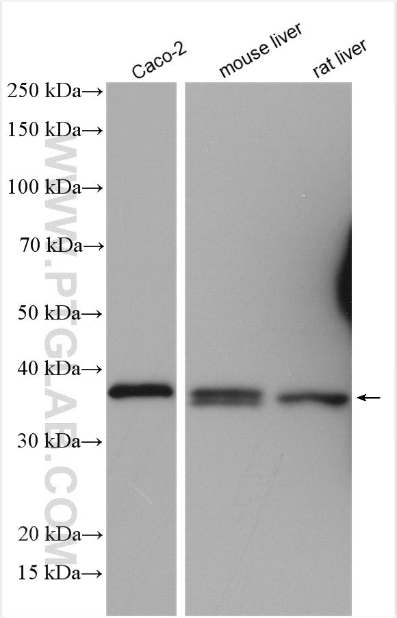 ARG2 antibody (14825-1-AP) | Proteintech | 武汉三鹰生物技术有限公司