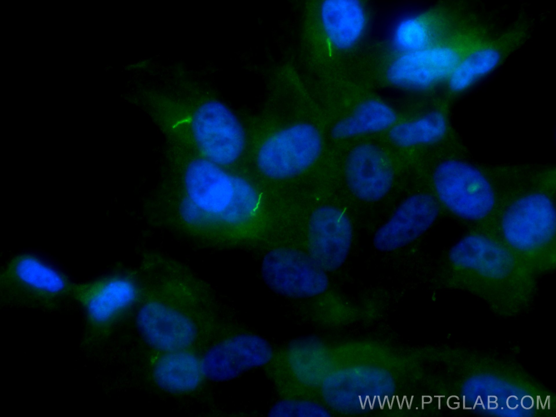 ARL13B antibody (17711-1-AP) | Proteintech