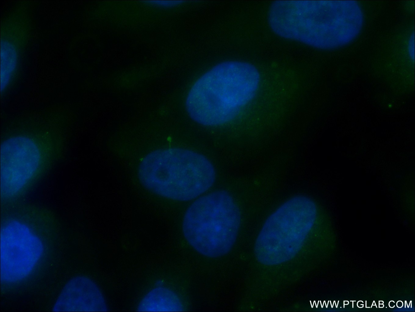 ARL13B antibody (66739-1-Ig) | Proteintech | 武汉三鹰生物技术有限公司