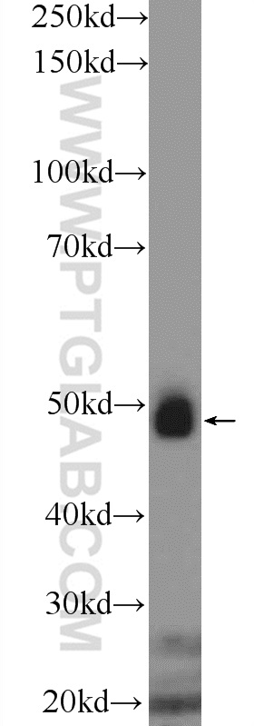 ASS1 antibody (16210-1-AP) | Proteintech | 武汉三鹰生物技术有限公司