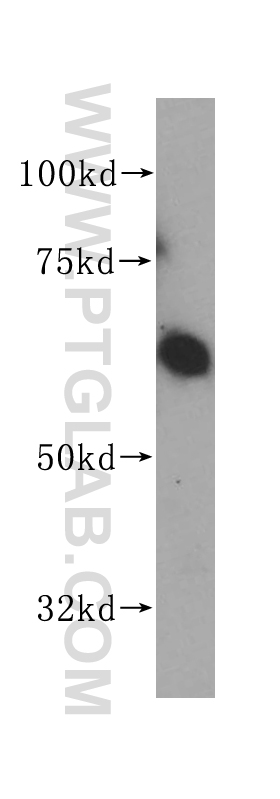 ASNS Antibody 14681-1-AP | Proteintech