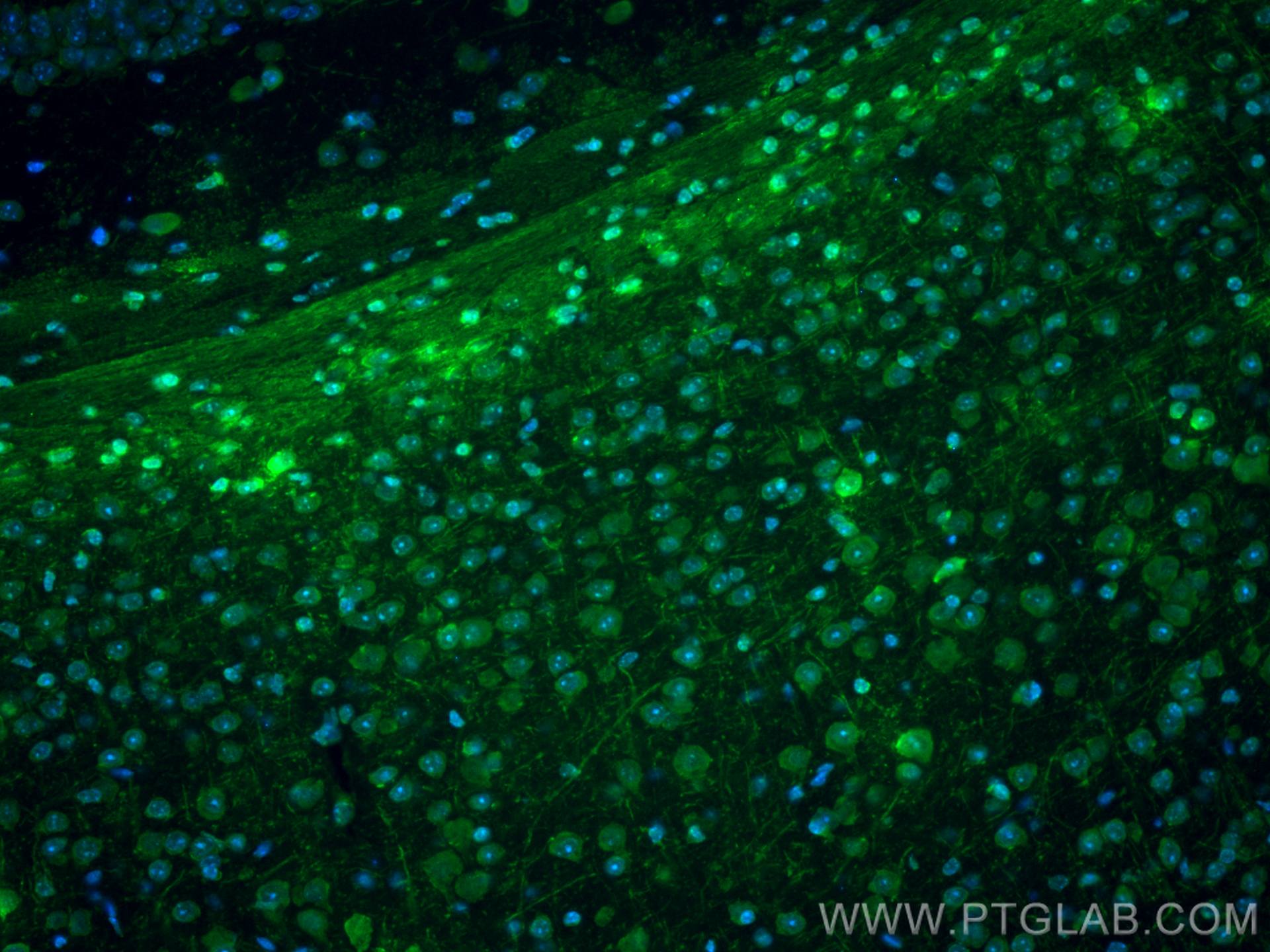 ATF4 antibody (CL488-10835) | Proteintech | 武汉三鹰生物技术有限公司
