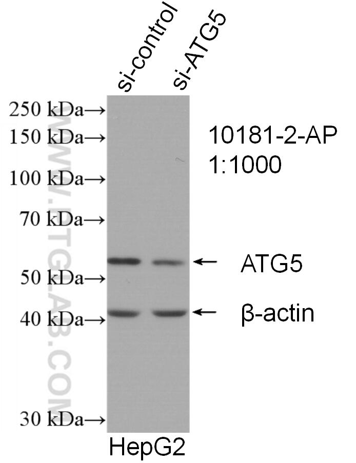 ATG5 antibody (10181-2-AP) | Proteintech