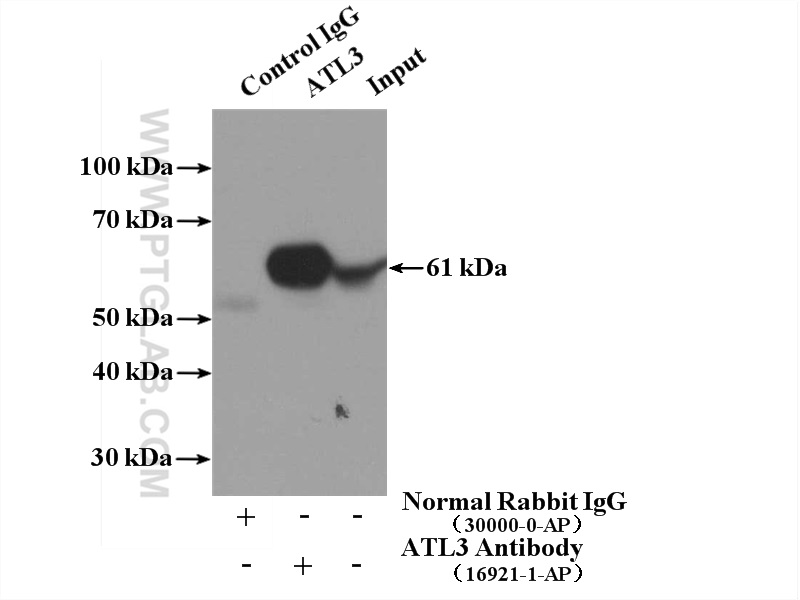 ATL3 antibody (16921-1-AP) | Proteintech | 武汉三鹰生物技术有限公司
