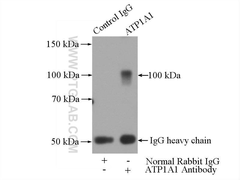 ATP1A1 antibody (14418-1-AP) | Proteintech | 武汉三鹰生物技术有限公司