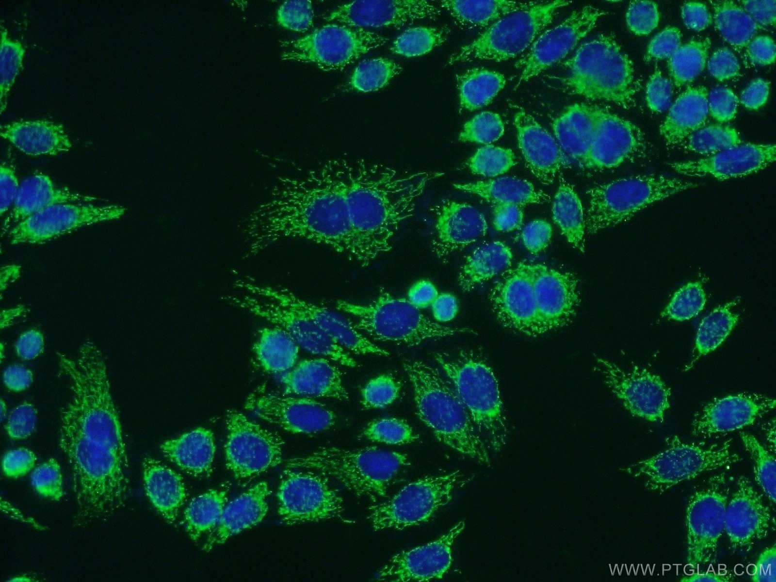 ATPB antibody (17247-1-AP) | Proteintech | 武汉三鹰生物技术有限公司