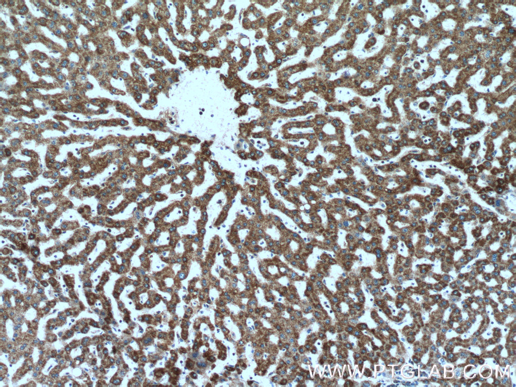 ATPB antibody (17247-1-AP) | Proteintech | 武汉三鹰生物技术有限公司