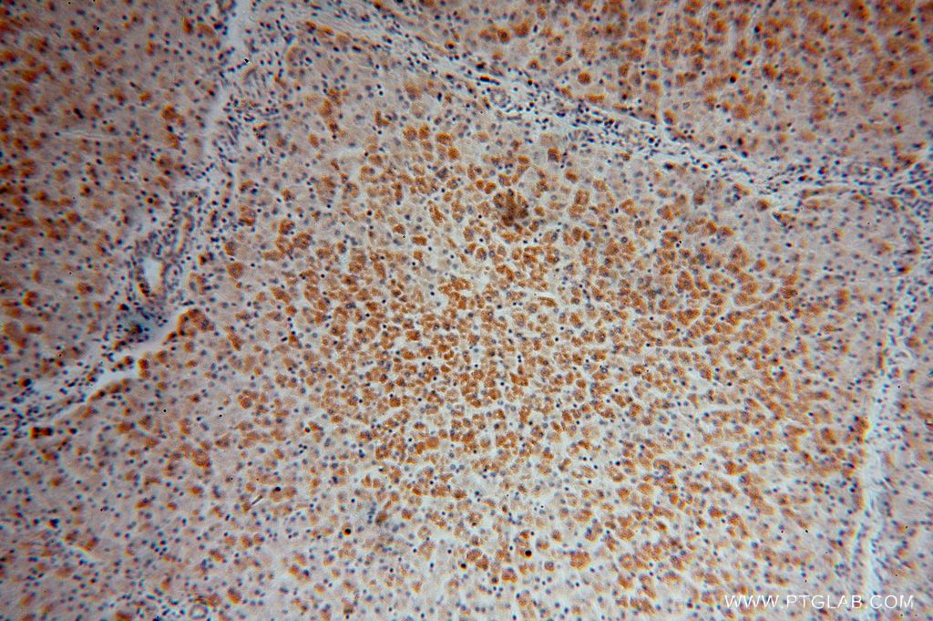 ATPB antibody (17247-1-AP) | Proteintech | 武汉三鹰生物技术有限公司
