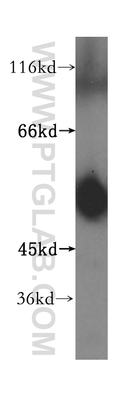 ATPB antibody (17247-1-AP) | Proteintech | 武汉三鹰生物技术有限公司