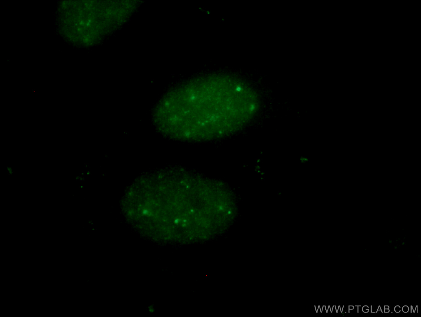 ATR Antibody 19787-1-AP | Proteintech