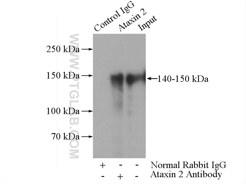 Ataxin 2 antibody (21776-1-AP) | Proteintech | 武汉三鹰生物技术有限公司