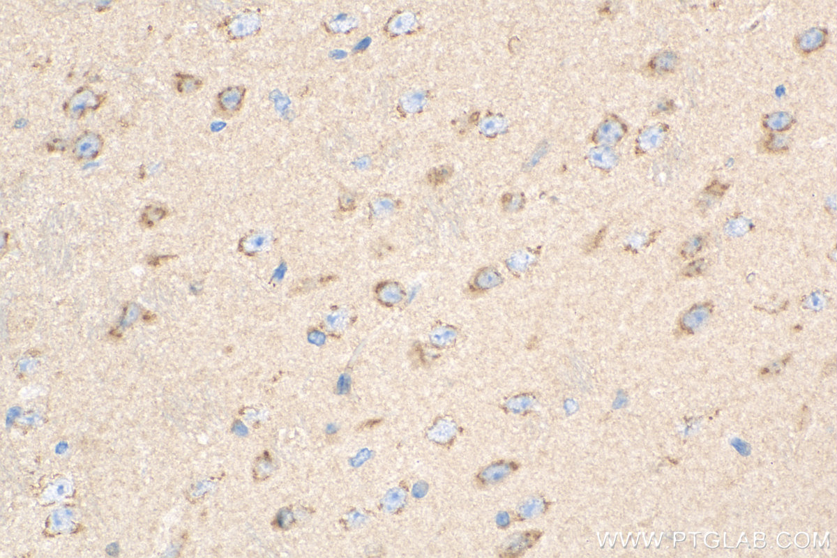 CD57 antibody (19401-1-AP) | Proteintech | 武汉三鹰生物技术有限公司