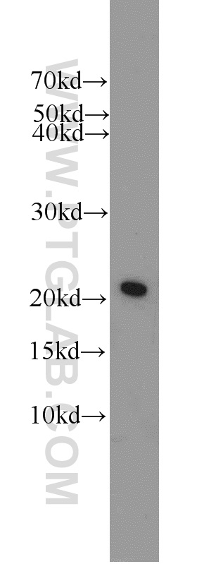 BAX Antibody 50599-2-Ig | Proteintech