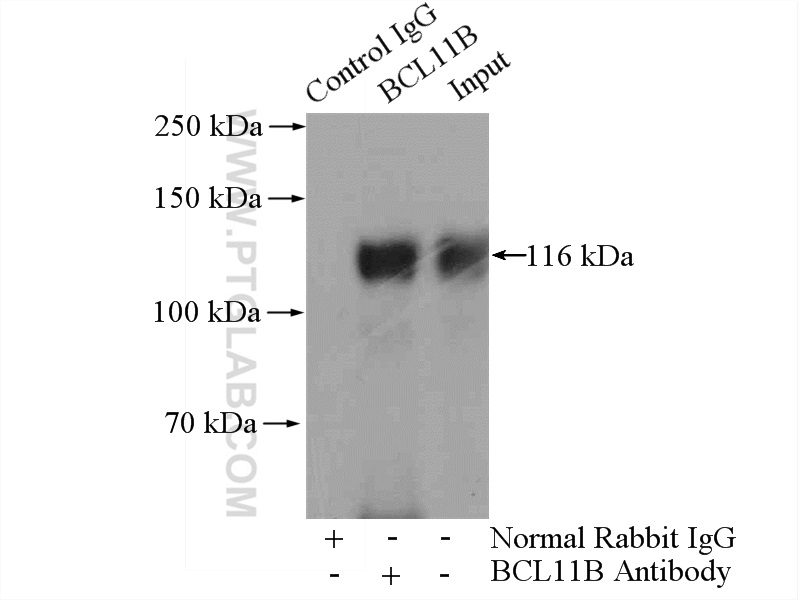BCL11B antibody (55414-1-AP) | Proteintech | 武汉三鹰生物技术有限公司