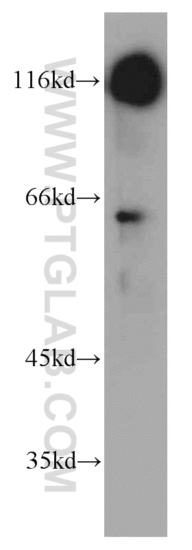 BCL11B antibody (55414-1-AP) | Proteintech | 武汉三鹰生物技术有限公司