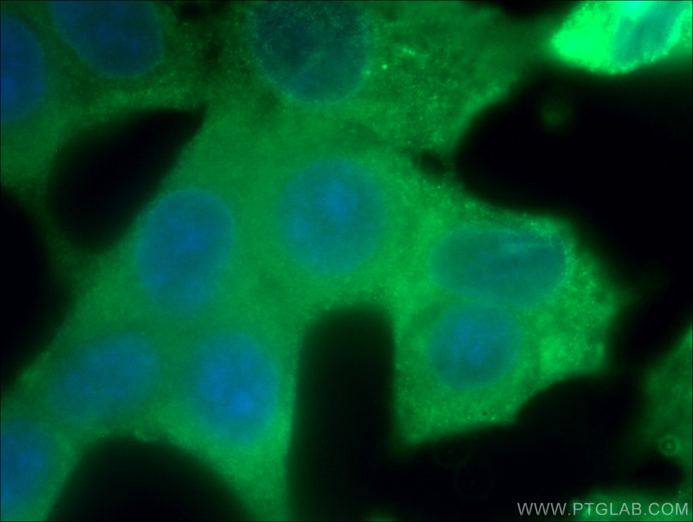 BCL2 Antibody 60178-1-Ig | Proteintech