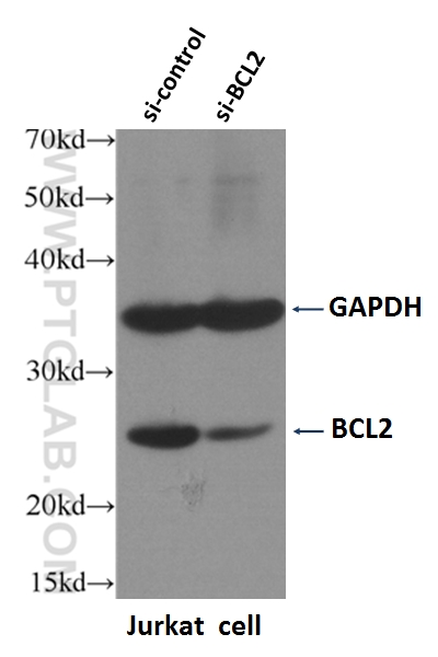 BCL2 Antibody 60178-1-Ig | Proteintech