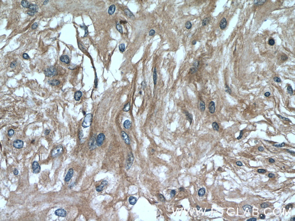 BCRP/ABCG2 Antibody 10051-1-AP | Proteintech