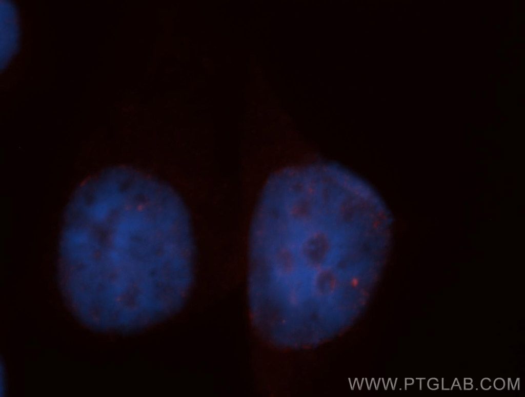 BMI1 antibody (10832-1-AP) | Proteintech | 武汉三鹰生物技术有限公司