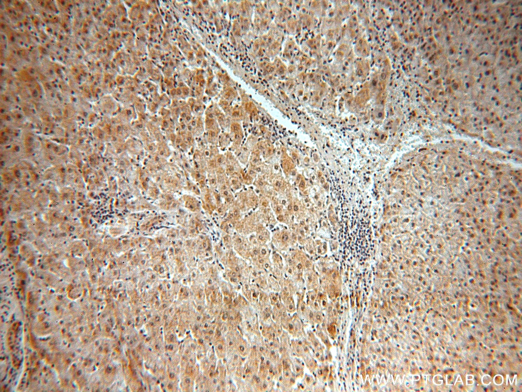 BMI1 antibody (10832-1-AP) | Proteintech | 武汉三鹰生物技术有限公司