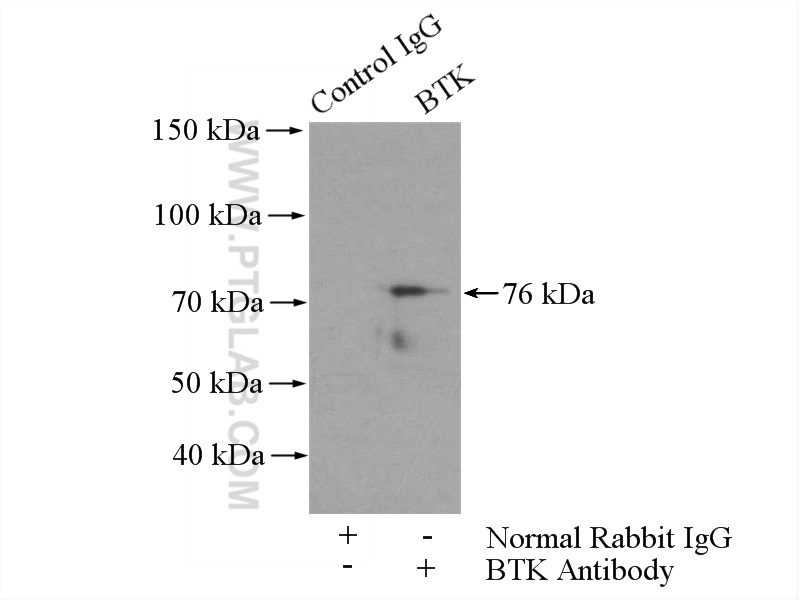 BTK antibody (21581-1-AP) | Proteintech | 武汉三鹰生物技术有限公司