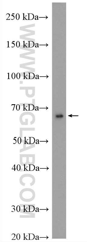 BTNL2 Antibody 25110-1-AP | Proteintech
