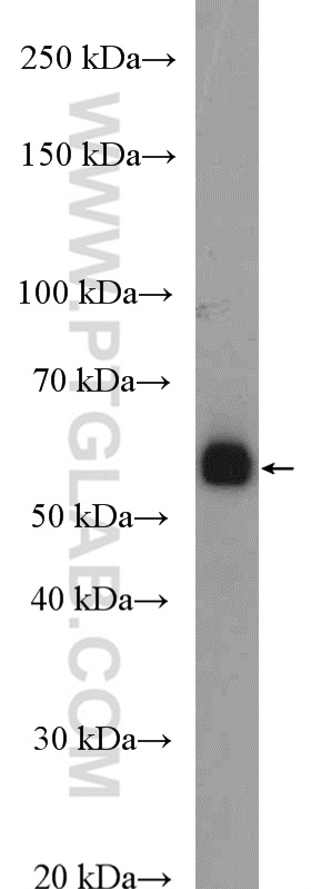 cGAS antibody (26416-1-AP) | Proteintech
