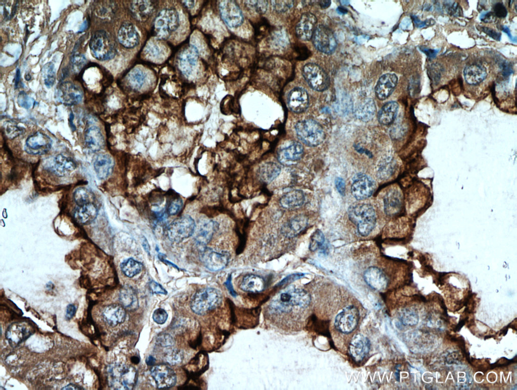 MUC1/CA15-3 N-terminal Antibody 19976-1-AP | Proteintech