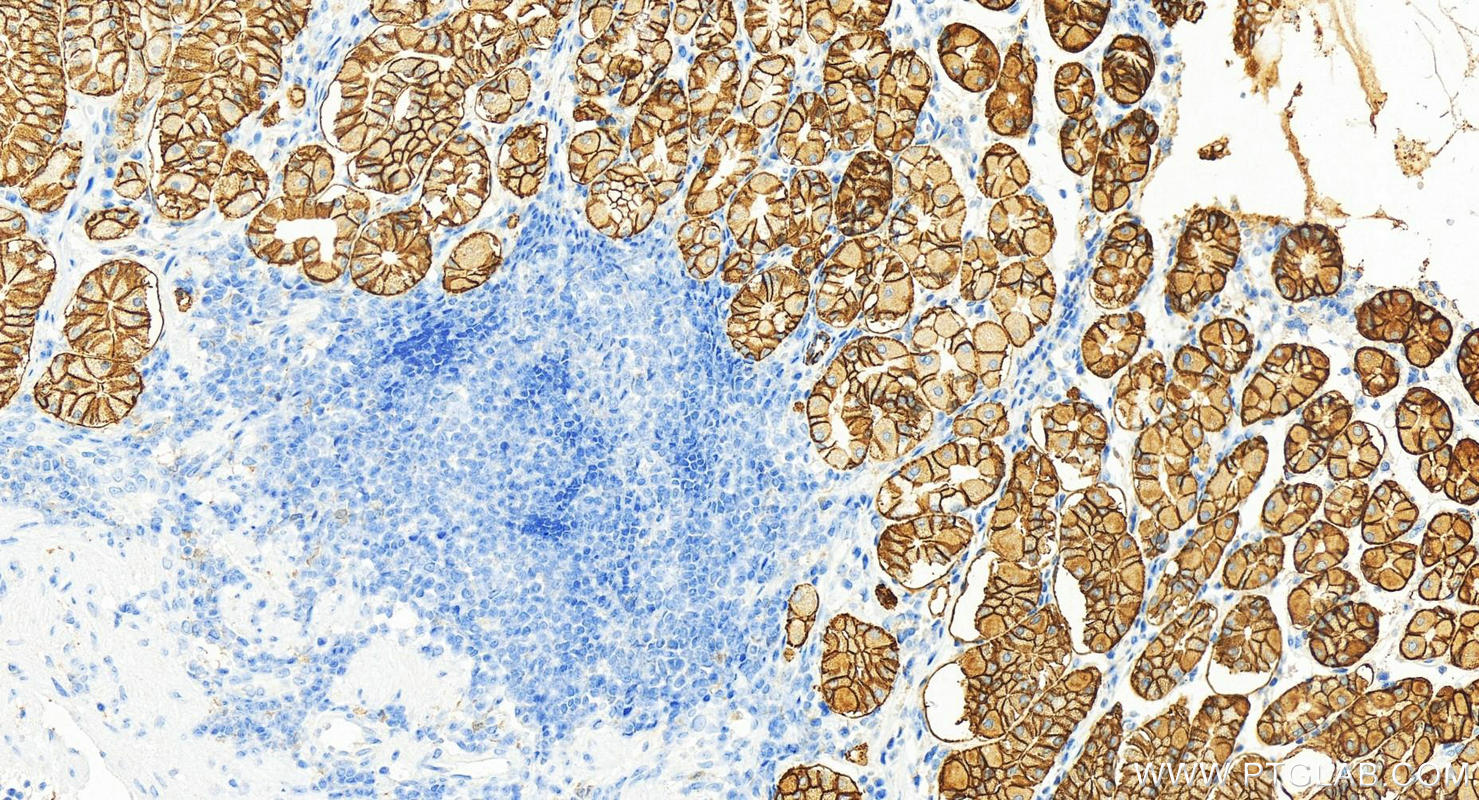 CA9 antibody (11071-1-AP) | Proteintech | 武汉三鹰生物技术有限公司